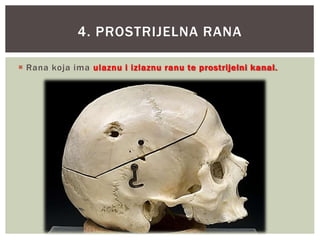 Rana i cijeljenje rane | PPSX
