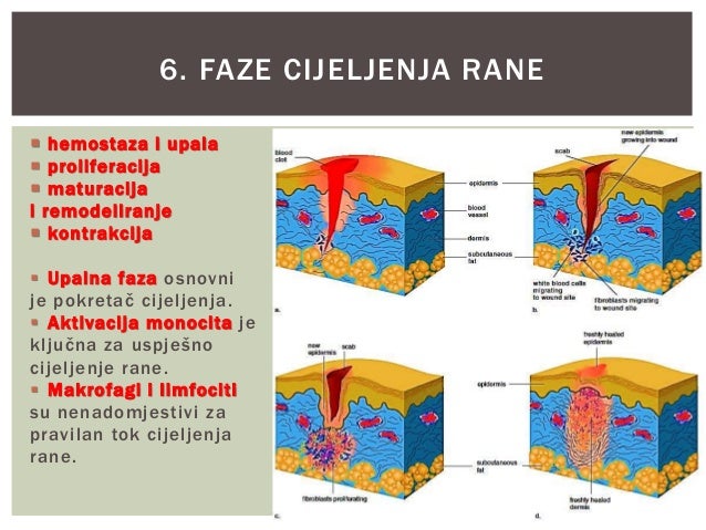 Rana i cijeljenje rane