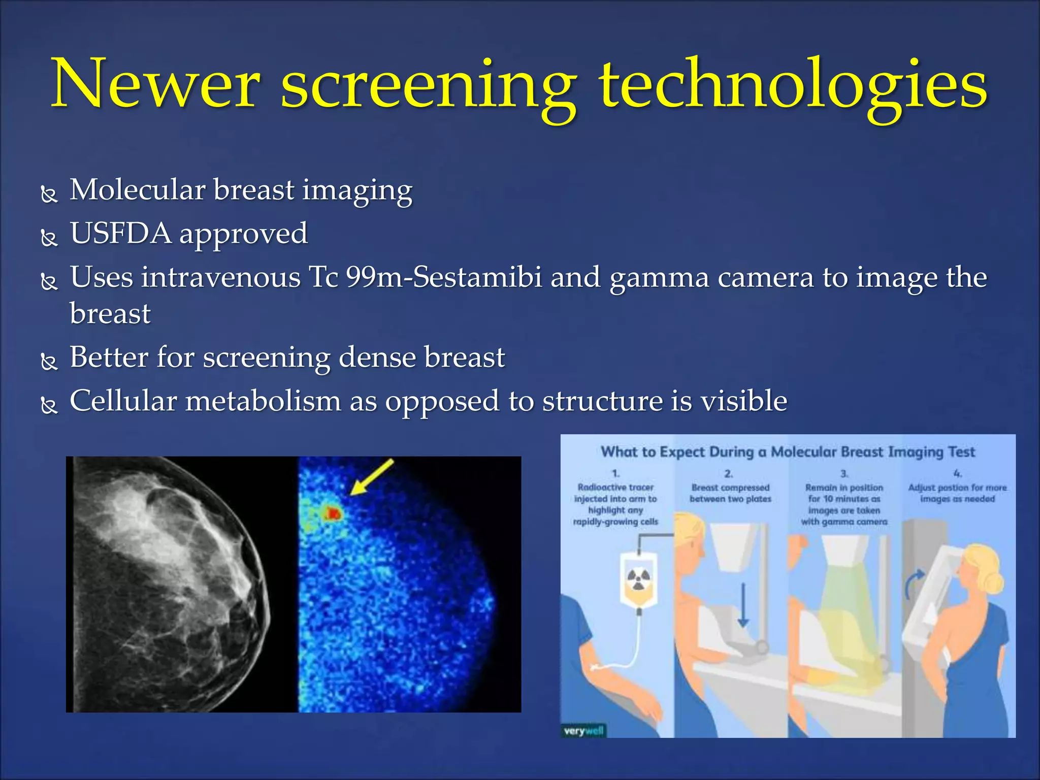Breast cancer screening | PPTX