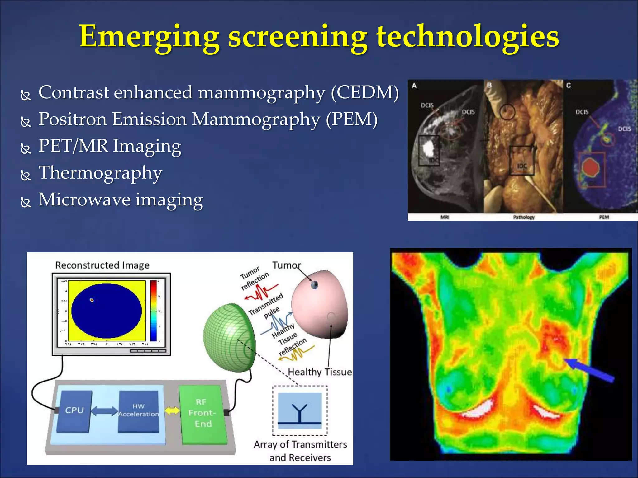Breast cancer screening | PPTX