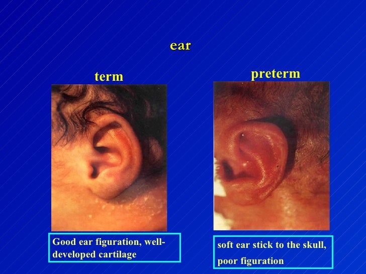 国际学院新生儿总论