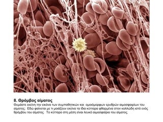 Φωτογραφιες του ανθρωπινου συστηματος | PPT