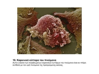 Φωτογραφιες του ανθρωπινου συστηματος | PPT