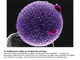 Φωτογραφιες του ανθρωπινου συστηματος | PPT