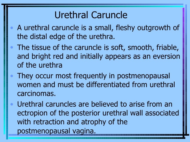 Benign & precancerous tumors of female genitale organs