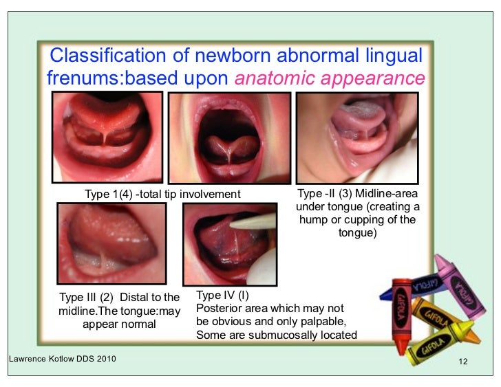 ל מצגת השקופיות של ד'ר לורנס קוטלוב