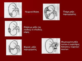 κακώσεις ουροποιητικού | PPT