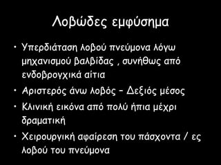 οξεία αναπνευστική δυσχέρεια του νεογνού | PPT