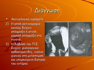συγγενές μεγάκολο | PPT