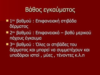 εγκαυμα | PPT