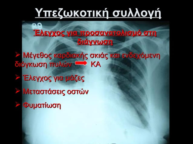 Eρμηνεία ακτινογραφίας θώρακος | PPT