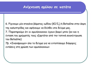 παρουσίαση μικροσκοπίας στο εκφε | PPT