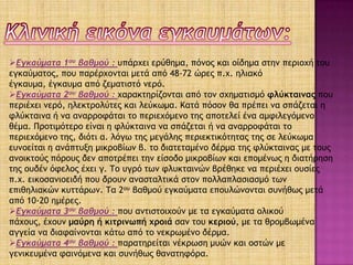 Εγκαυματα- Κούγκουλα Ελπινίκη | PPT
