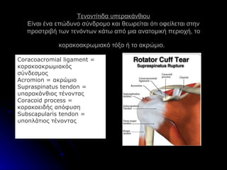ΤΕΝΟΝΤΙΤΙΔΕΣ | PPT