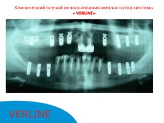 Бизнес-Проект "МОДЕРНИЗАЦИЯ ПРОИЗВОДСТВА дентальных имплантатов" | PPT