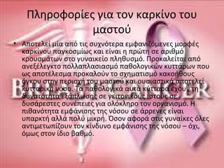καρκινος μαστου | PPT