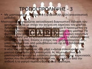 καρκινος μαστου | PPT