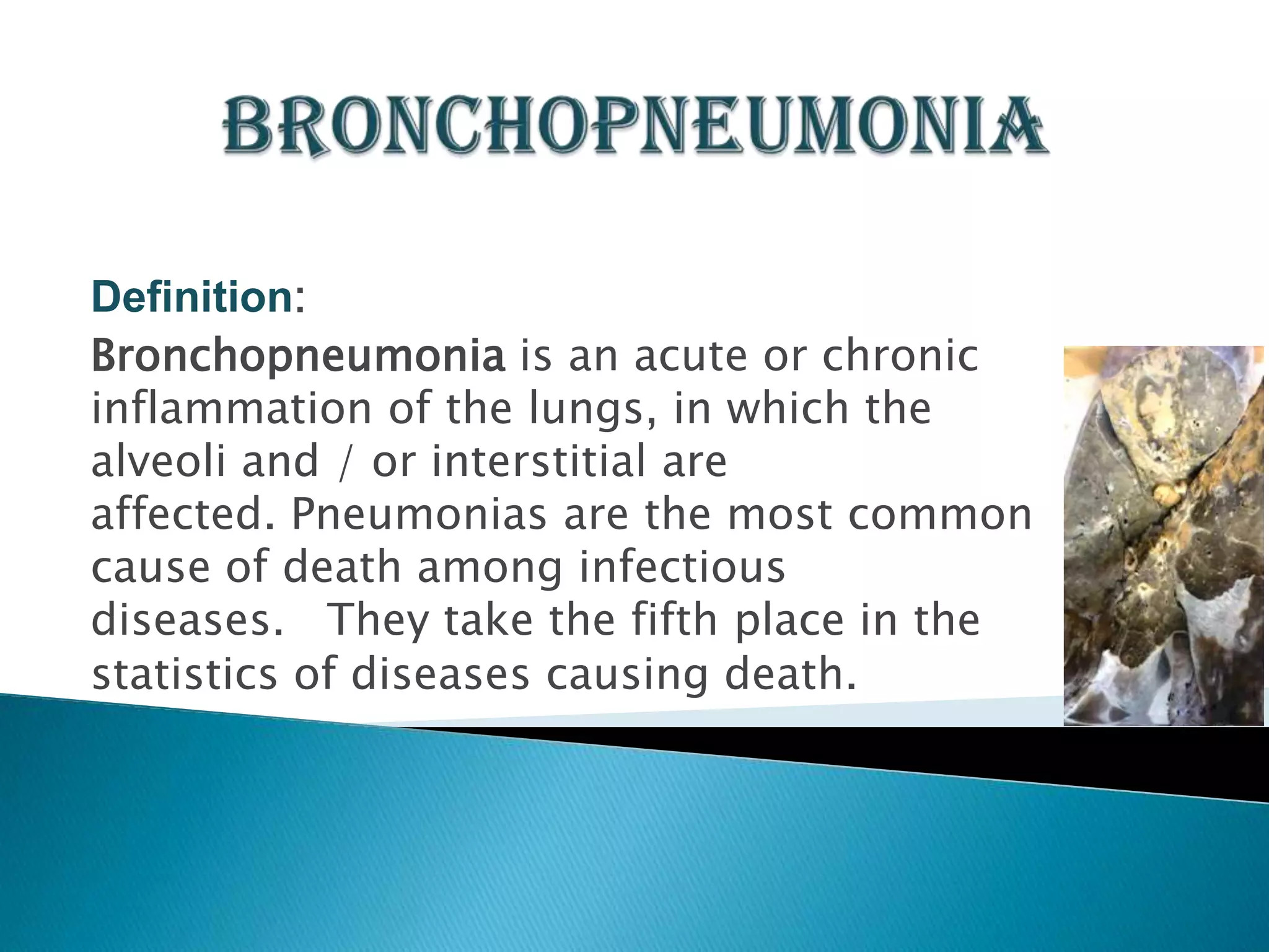 bronchopneumonia . moldova USMF | PPTX