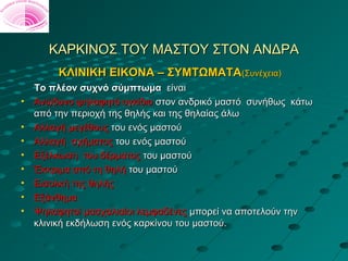 καρκινοσ του μαστου στον ανδρα | PPT