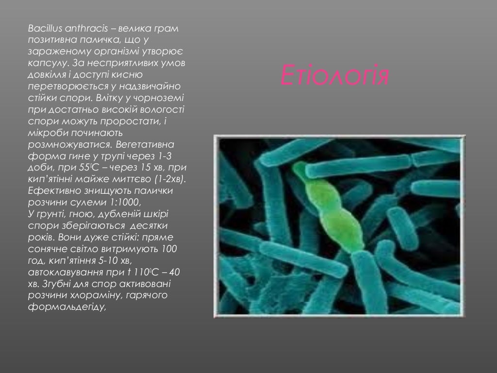 сибірка