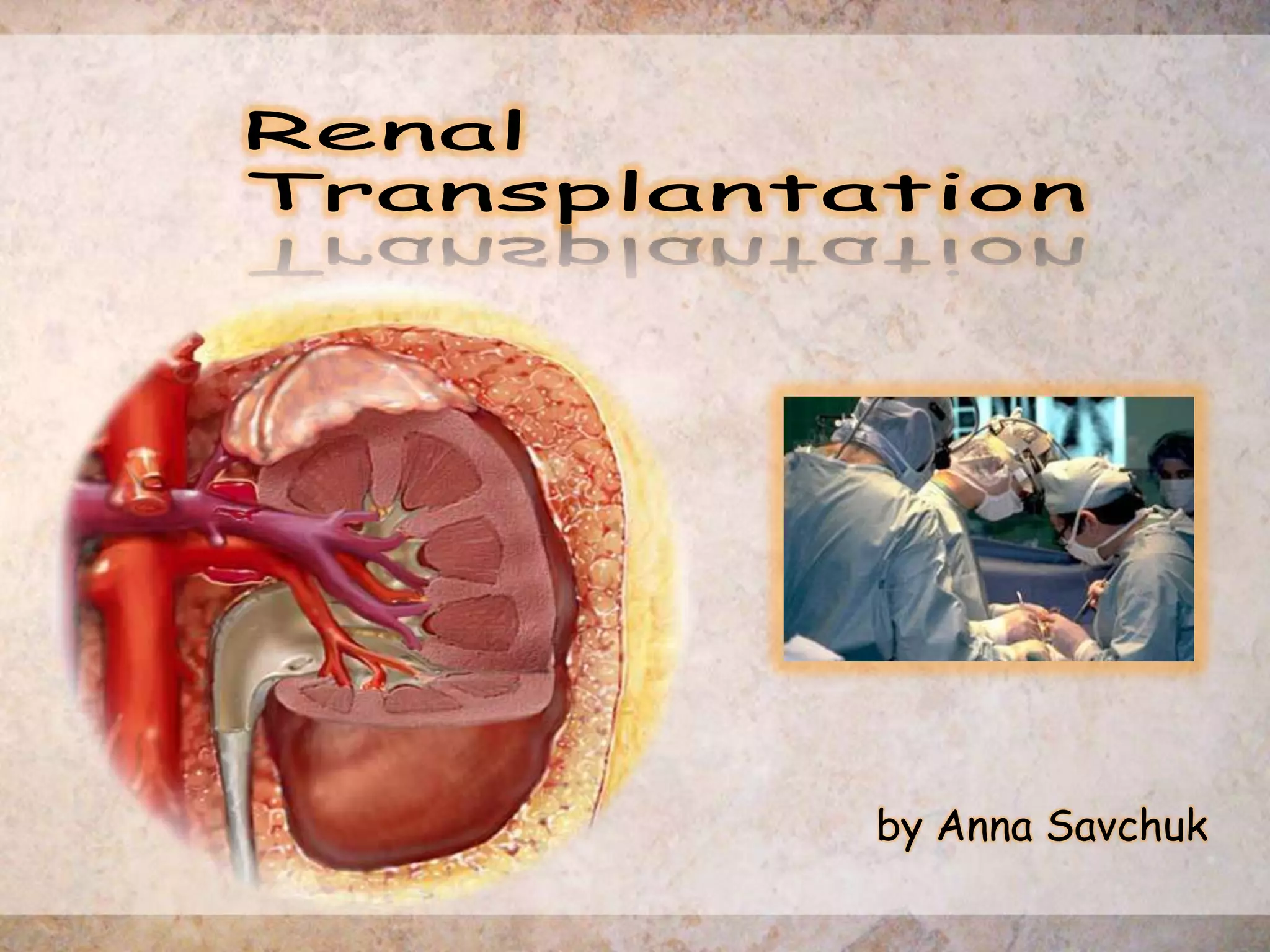 Renal transplantation | PPTX