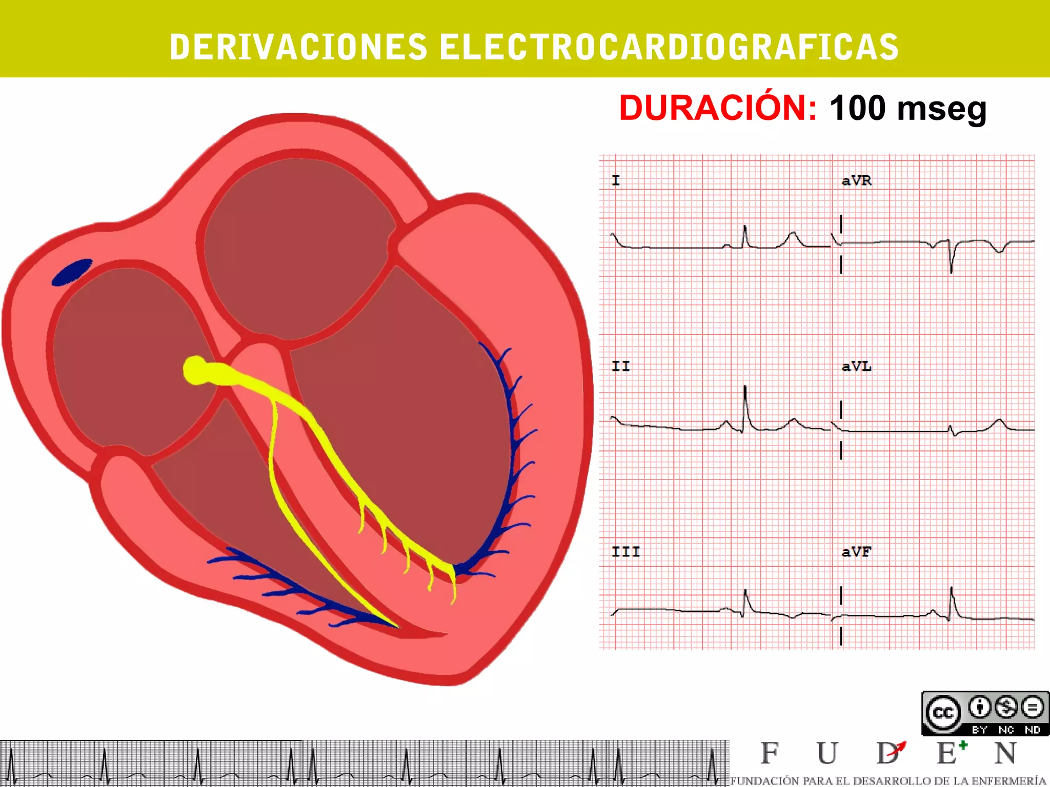 ECG. Día 1. Principios básicos 2. | PPT