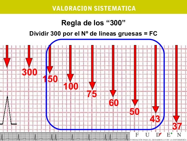 ECG. Día 2. Revisión sistemática.