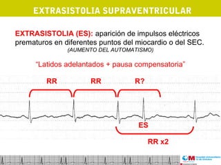 ECG. Día 3. Taquiarritmias | PPT