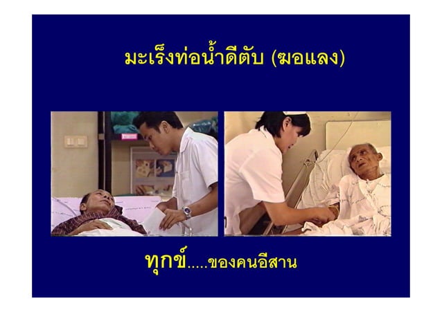 พยาธิใบไม้ตับและมะเร็งท่อน้ำดี | PDF