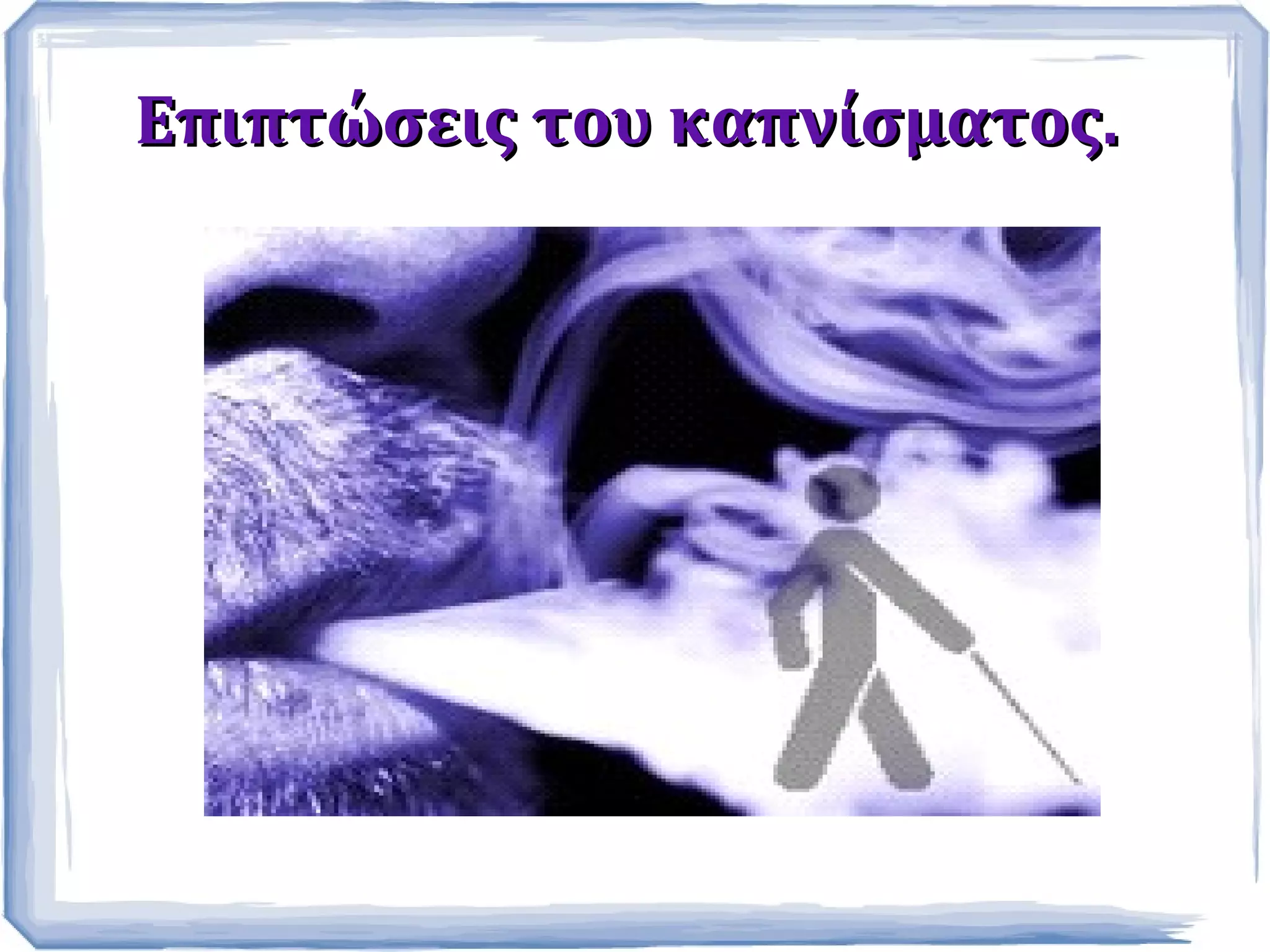 Καπνισμα - αλκοόλ | ODP