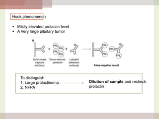 Hyperprolactinemia work up | PPTX