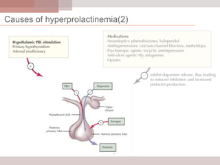 Hyperprolactinemia work up | PPTX