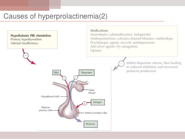 Hyperprolactinemia work up
