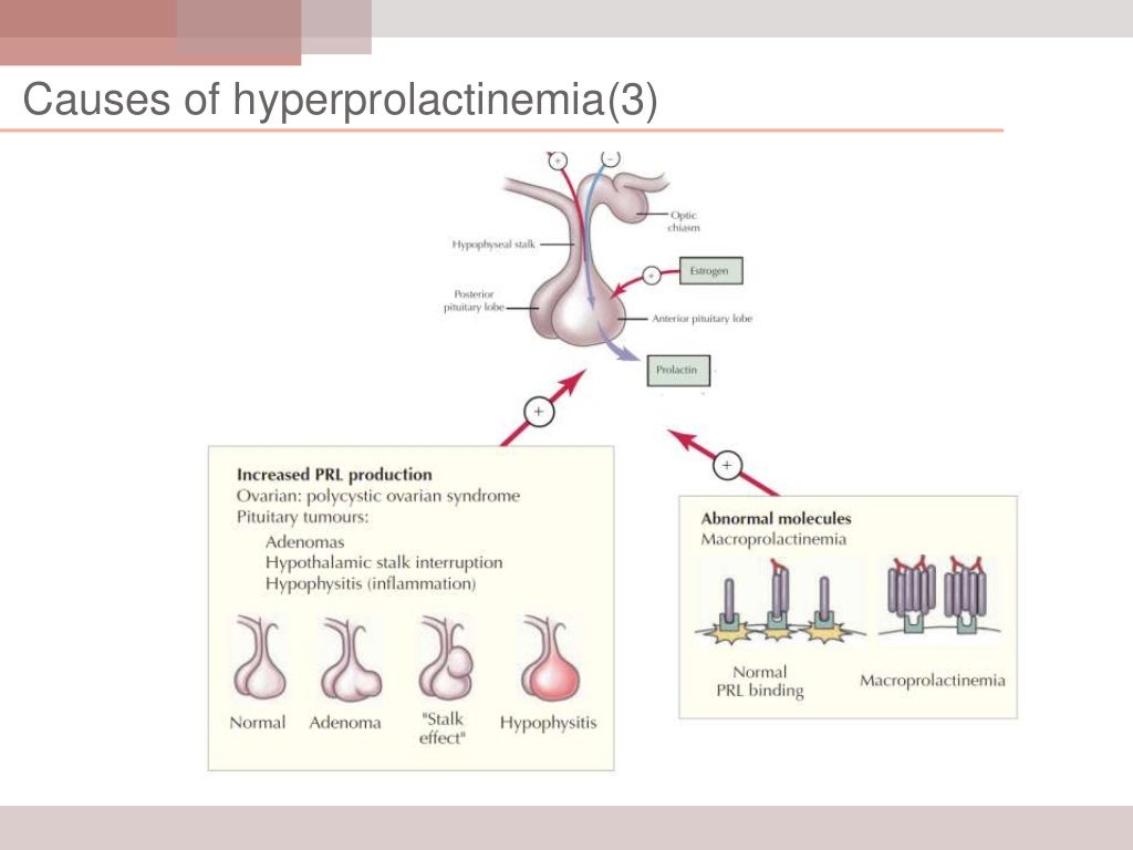 Hyperprolactinemia work up