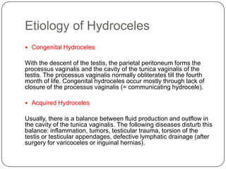 Hydrocele in children | PPTX