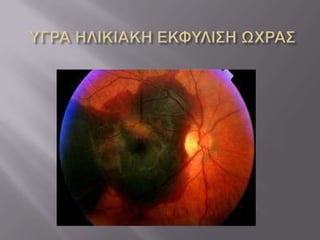 Ηλικιακή Εκφύλιση Ώχρας | PPT