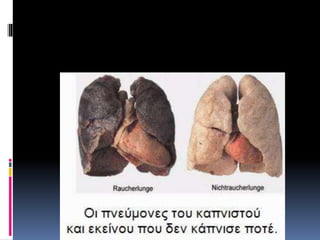 κάπνισμα και εφηβεία | PPTX