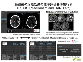 脳腫瘍における定量医用画像評価法の基準とその解析手法 | PDF