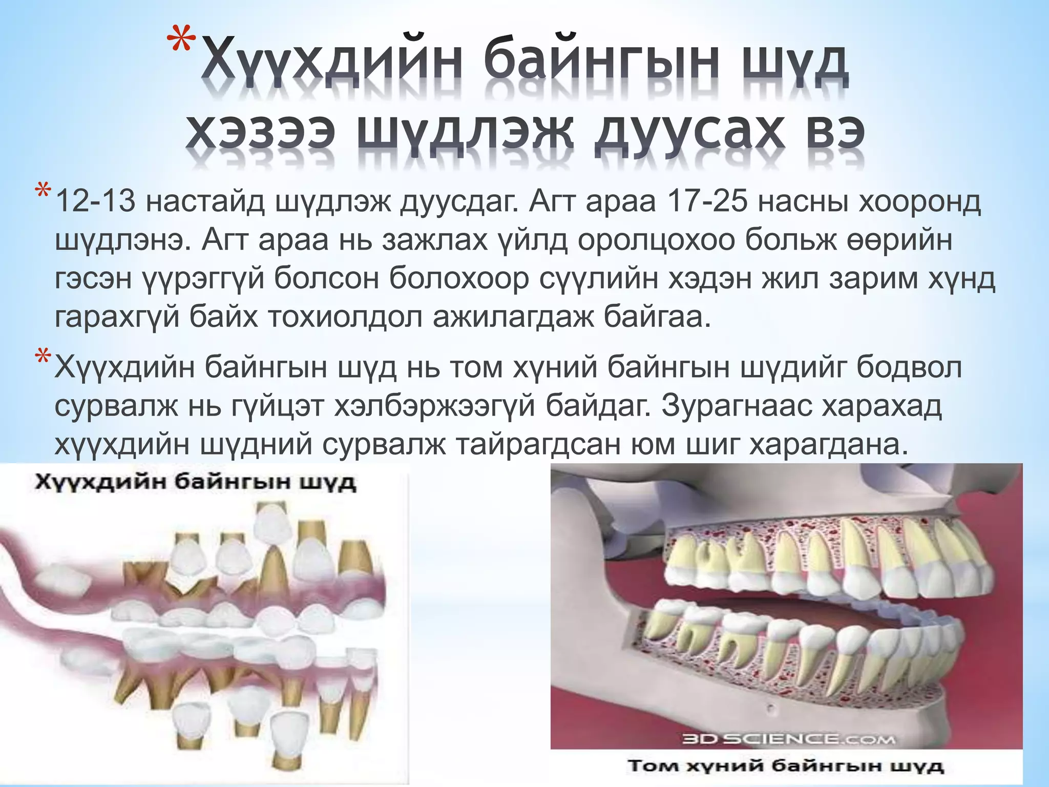 сүүн шүд болон байнгын шүдний онцлог Pptx