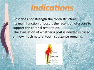 dental post and core | PPTX