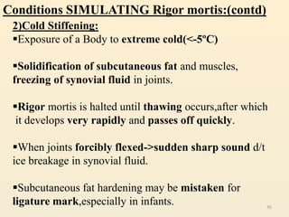 RIGOR MORTIS by rajkumar malur | PPTX