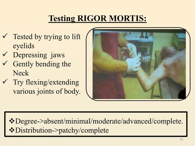 RIGOR MORTIS by rajkumar malur | PPT