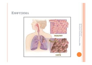 H αναπνοή στον άνθρωπο (Α γυμνασίου) | PDF