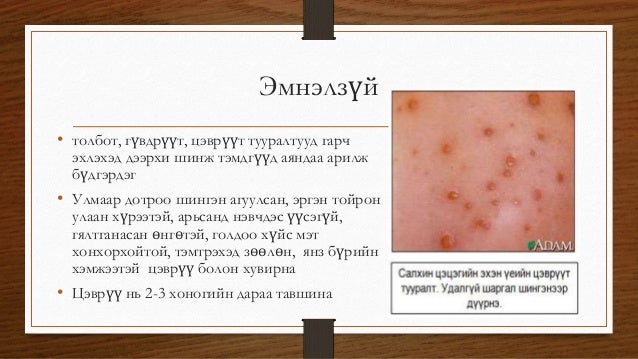 салхин цэцэг