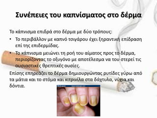ΣΥΝΕΠΕΙΕΣ ΤΟΥ ΚΑΠΝΙΣΜΑΤΟΣ | PPTX