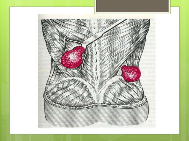 Lumbar triangle(Petit’s triangle) and it’s anatomical characteristics ...