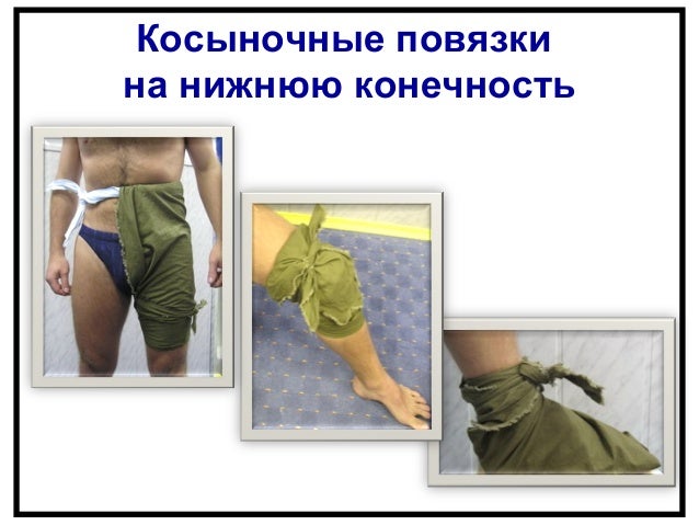 косыночные повязки
