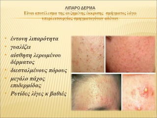 θεραπειες λιπαρού δέρματος | PPT
