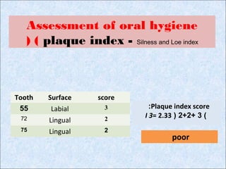 peadodontic case by najma alamami | PPT | Oral care | Personal Care