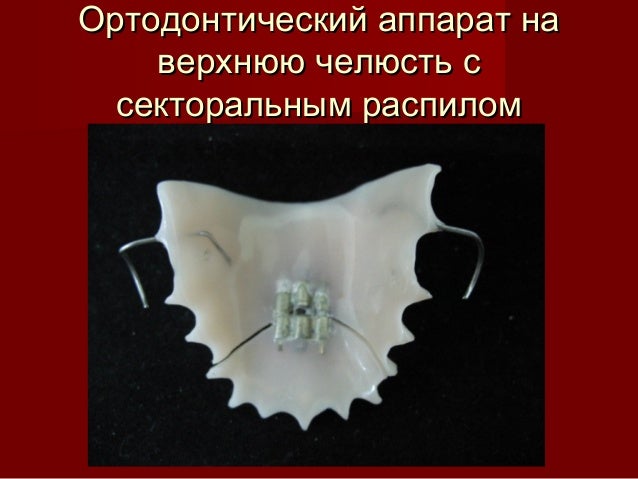 ортодонтия